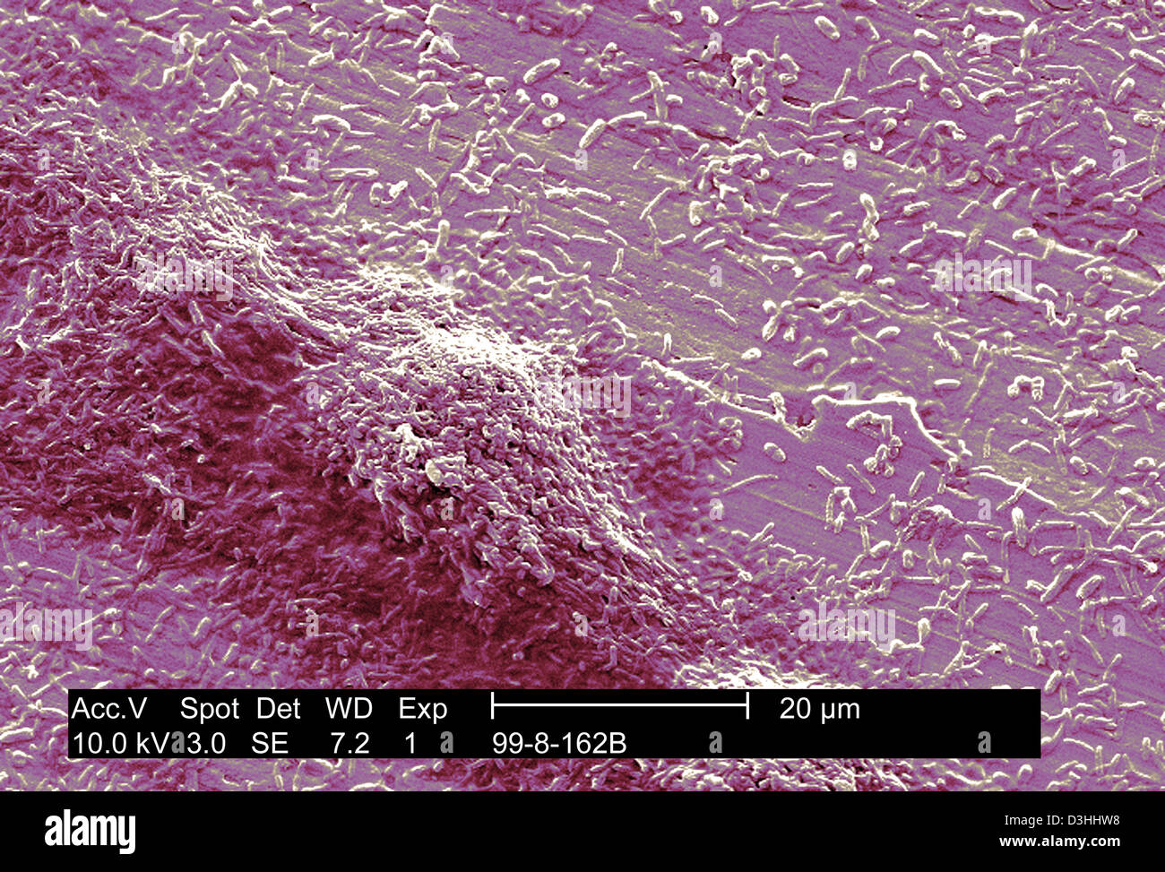 Legionellaceae hi-res stock photography and images - Alamy