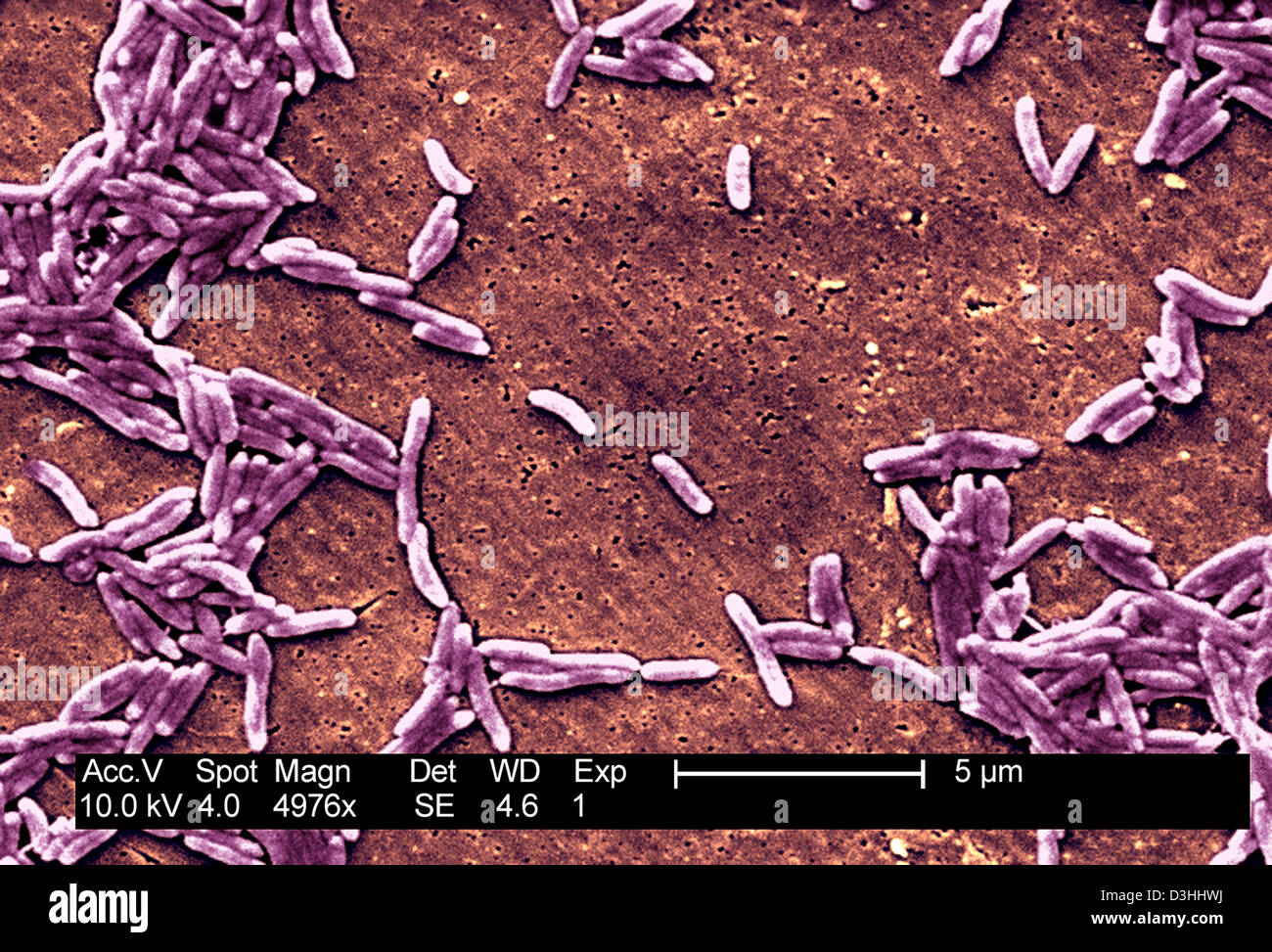 Bacteria campylobacter hi-res stock photography and images - Alamy