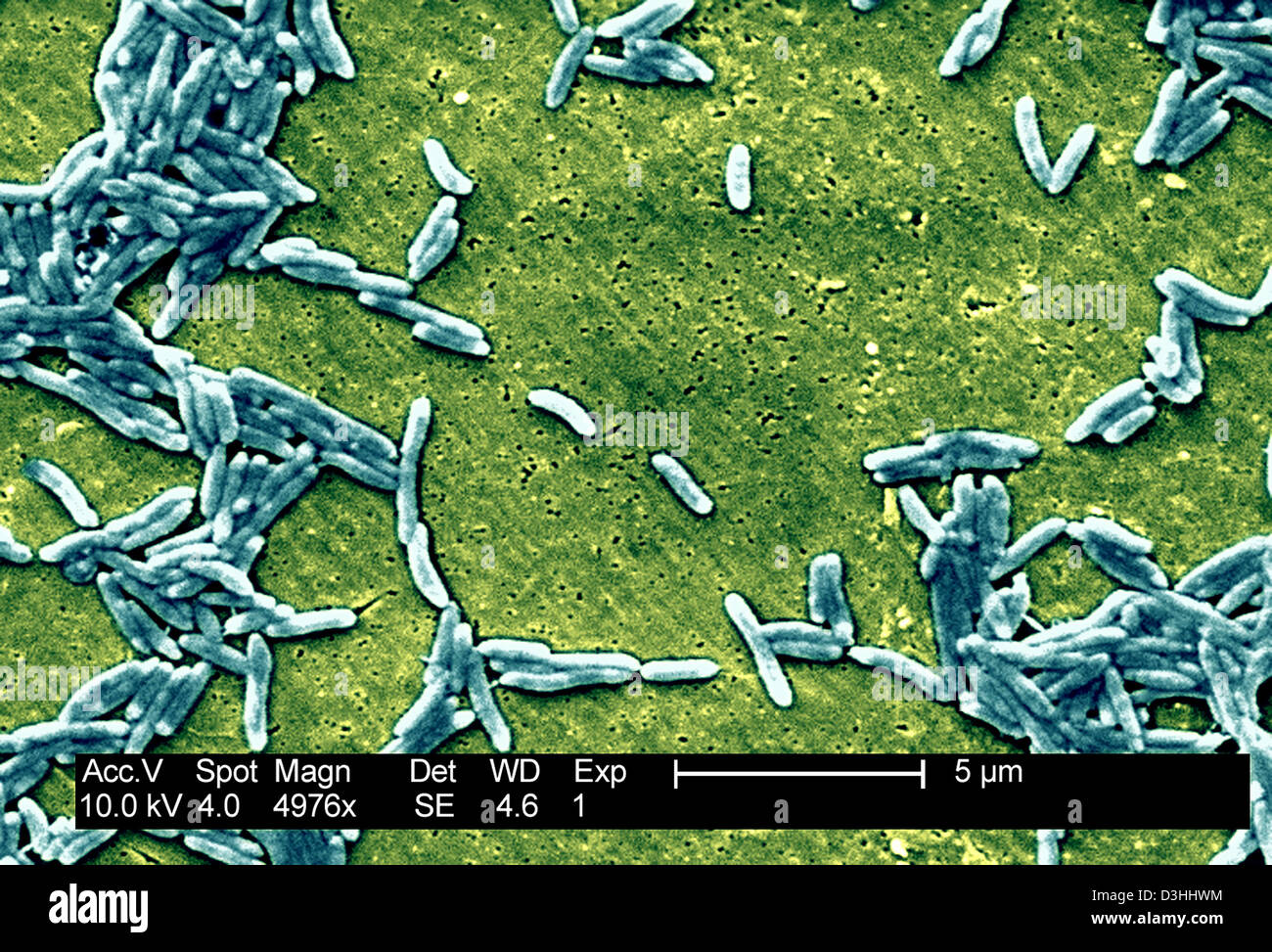 Campylobacter bacteria hi-res stock photography and images - Alamy