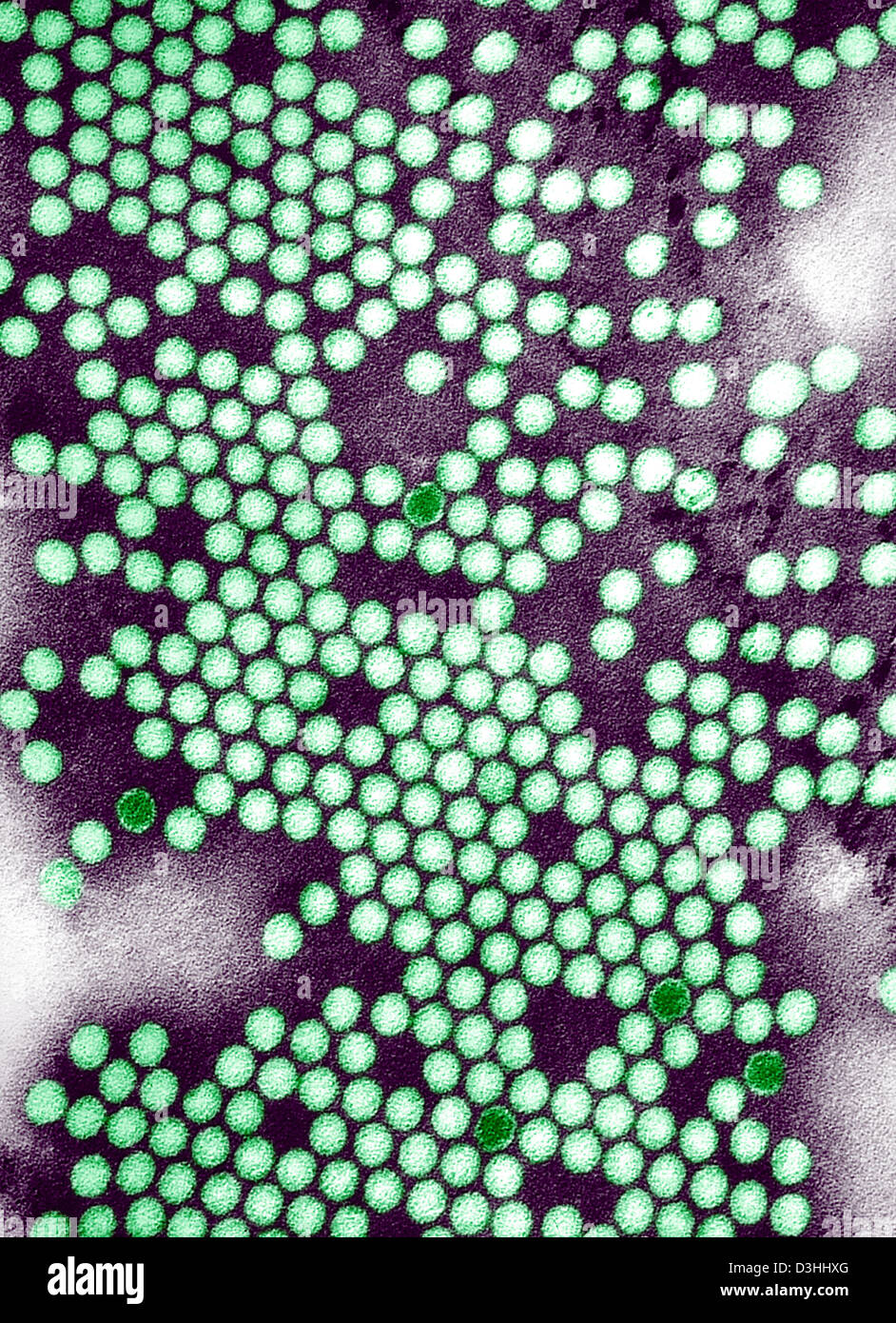 Polio virus microscope hi-res stock photography and images - Alamy
