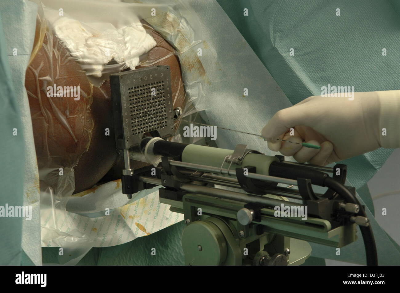 Prostate Machine Rifle