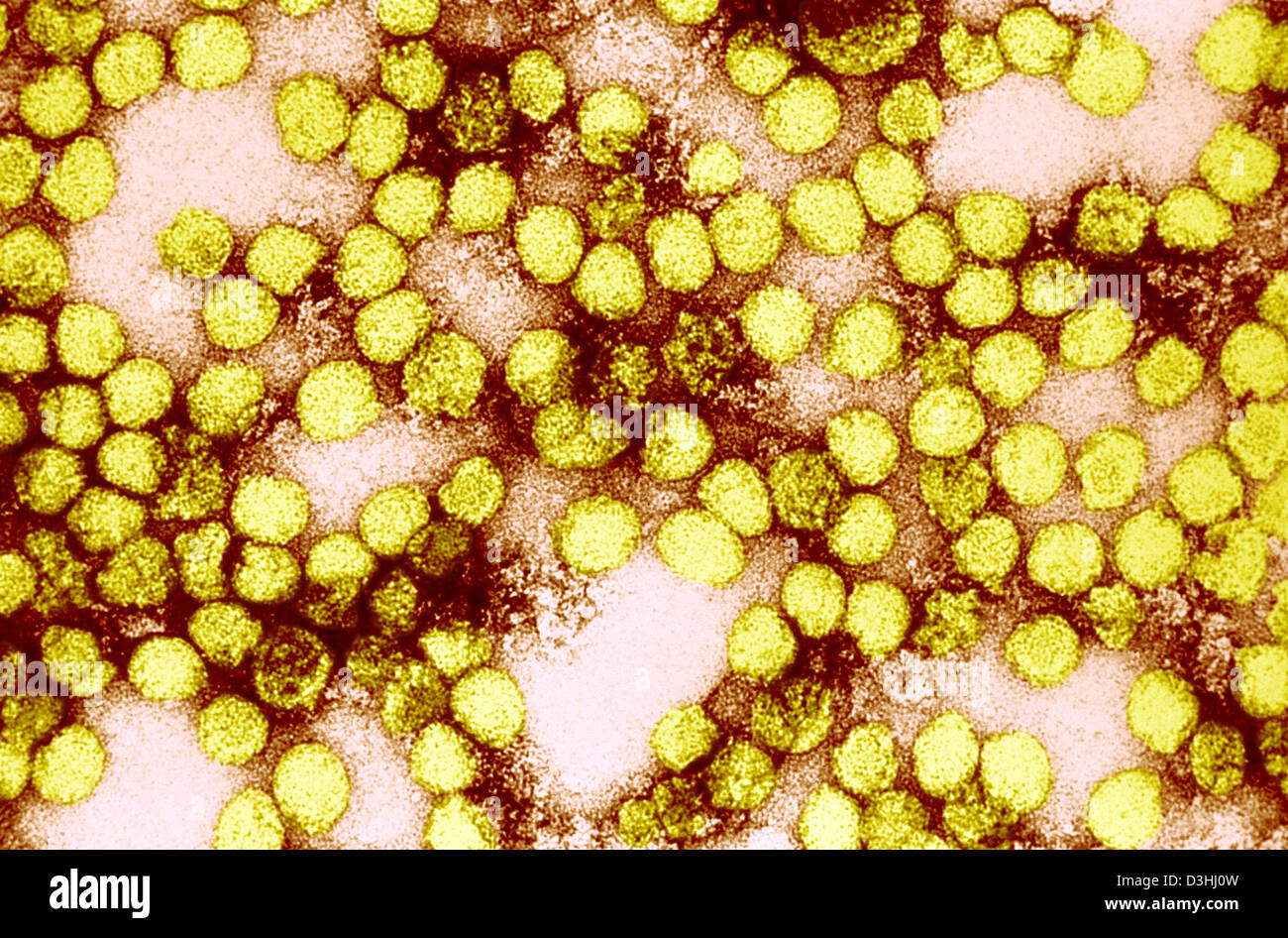 YELLOW FEVER VIRUS Stock Photo - Alamy