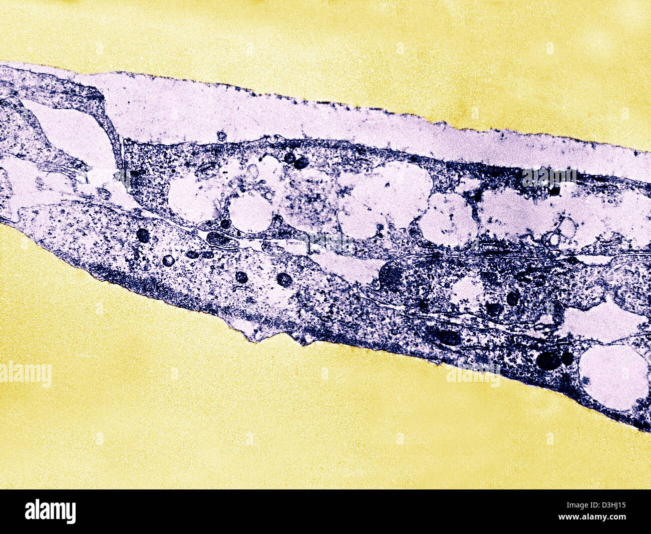 Treponema pallidum micrograph hi-res stock photography and images - Alamy