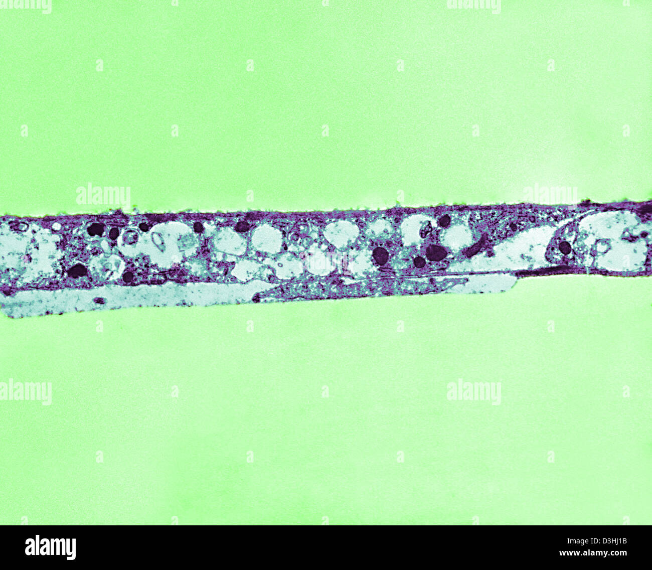 Treponema pallidum micrograph hi-res stock photography and images - Alamy