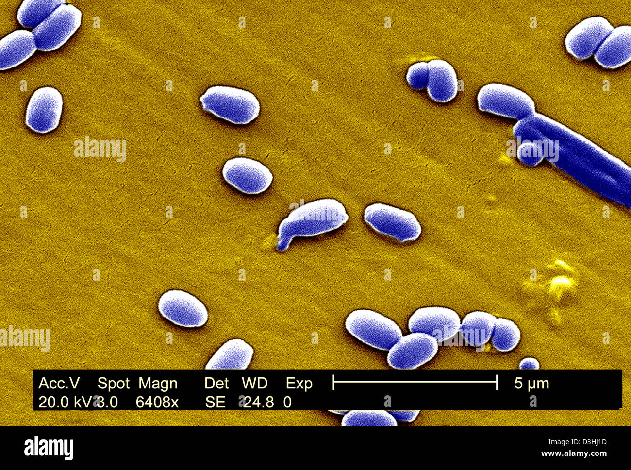 Bacillus anthracis micrograph hi-res stock photography and images - Alamy