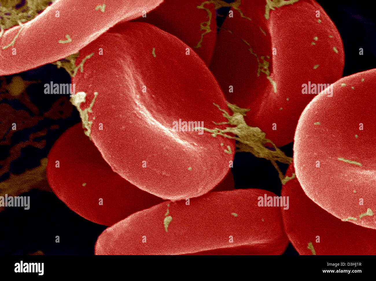 RED BLOOD CELL, SEM Stock Photo - Alamy