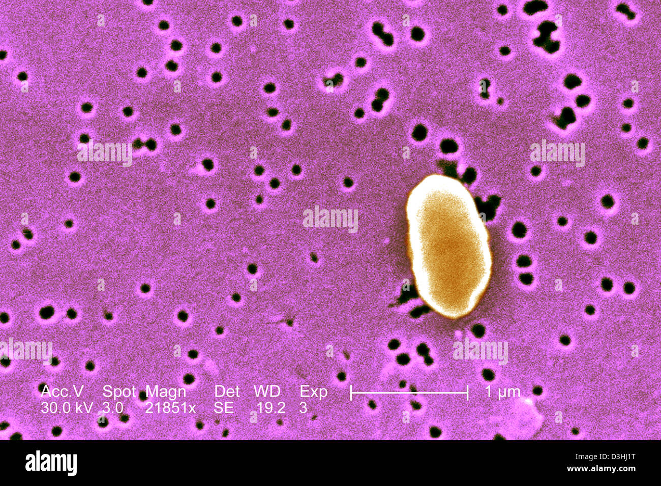Vibrio Parahaemolyticus