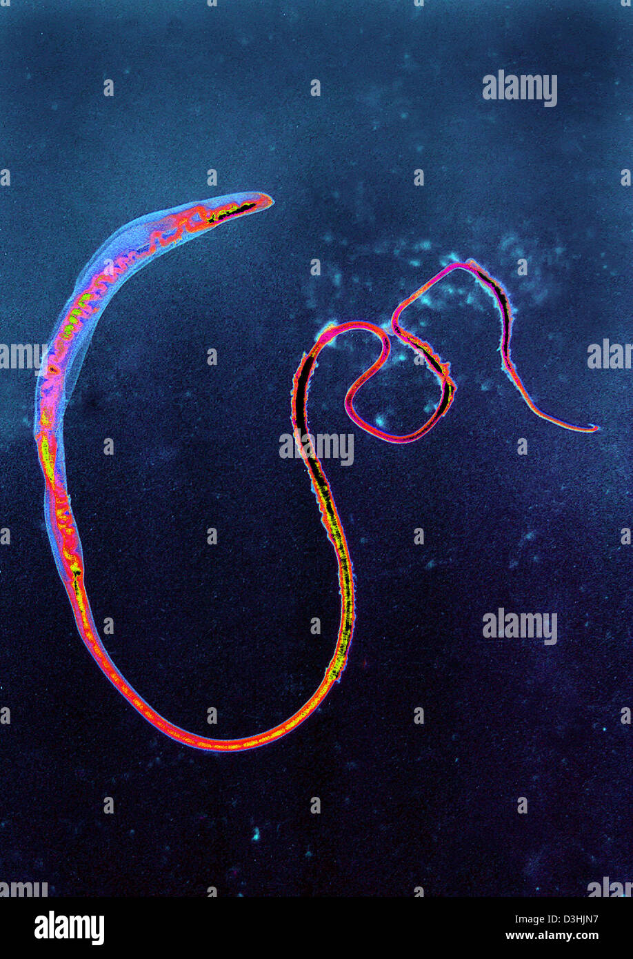 Anemias hi-res stock photography and images - Alamy