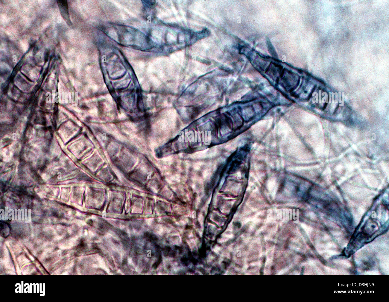 Dermatophytes hi-res stock photography and images - Alamy