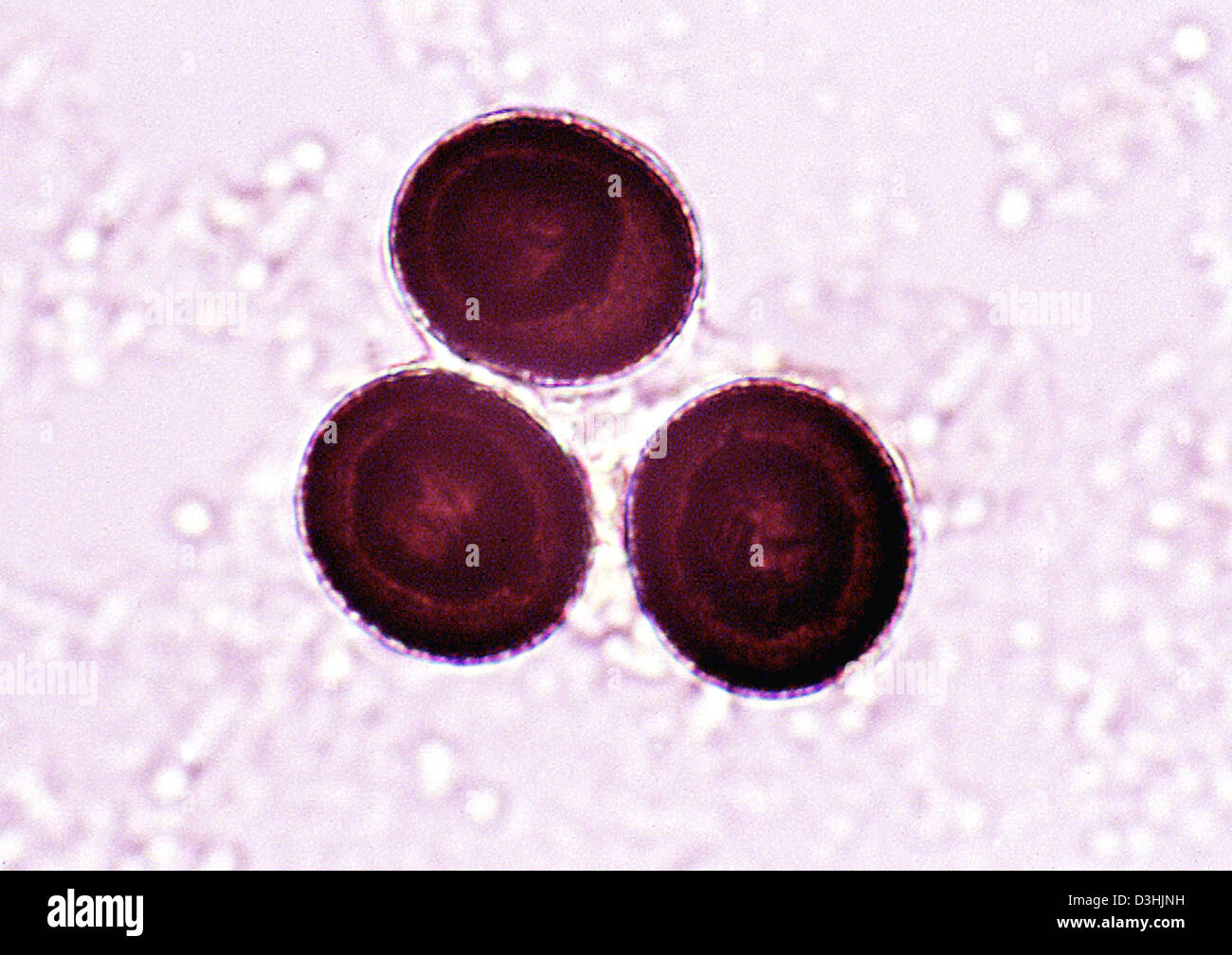 Ascaris infection hi-res stock photography and images - Alamy