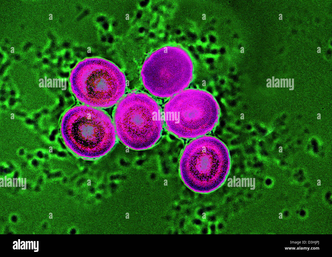Ascariasis Stock Photos & Ascariasis Stock Images - Alamy