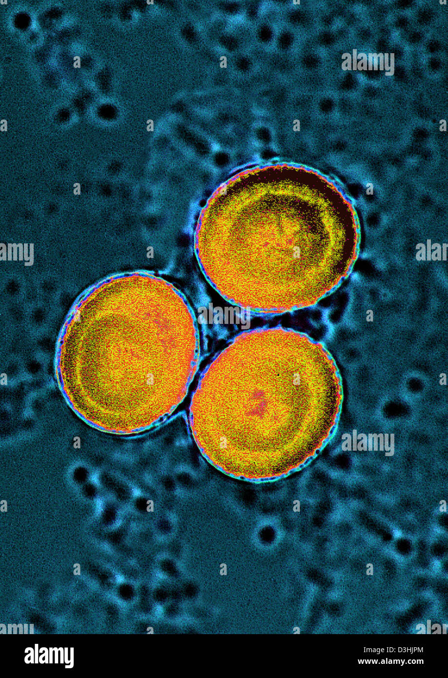 Ascaris infection hi-res stock photography and images - Alamy