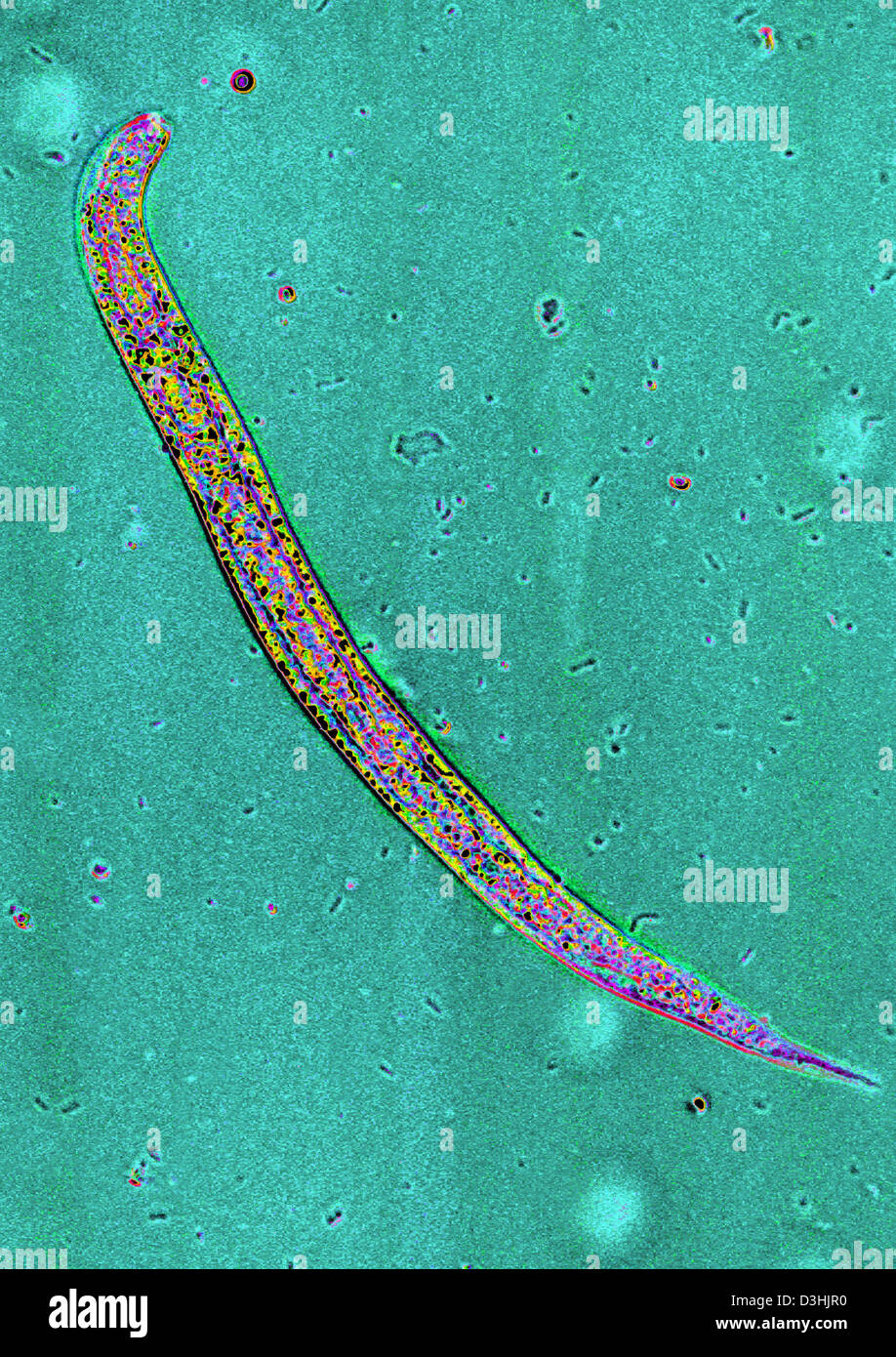Strongyloides stercoralis nematode worm hi-res stock photography and images - Alamy