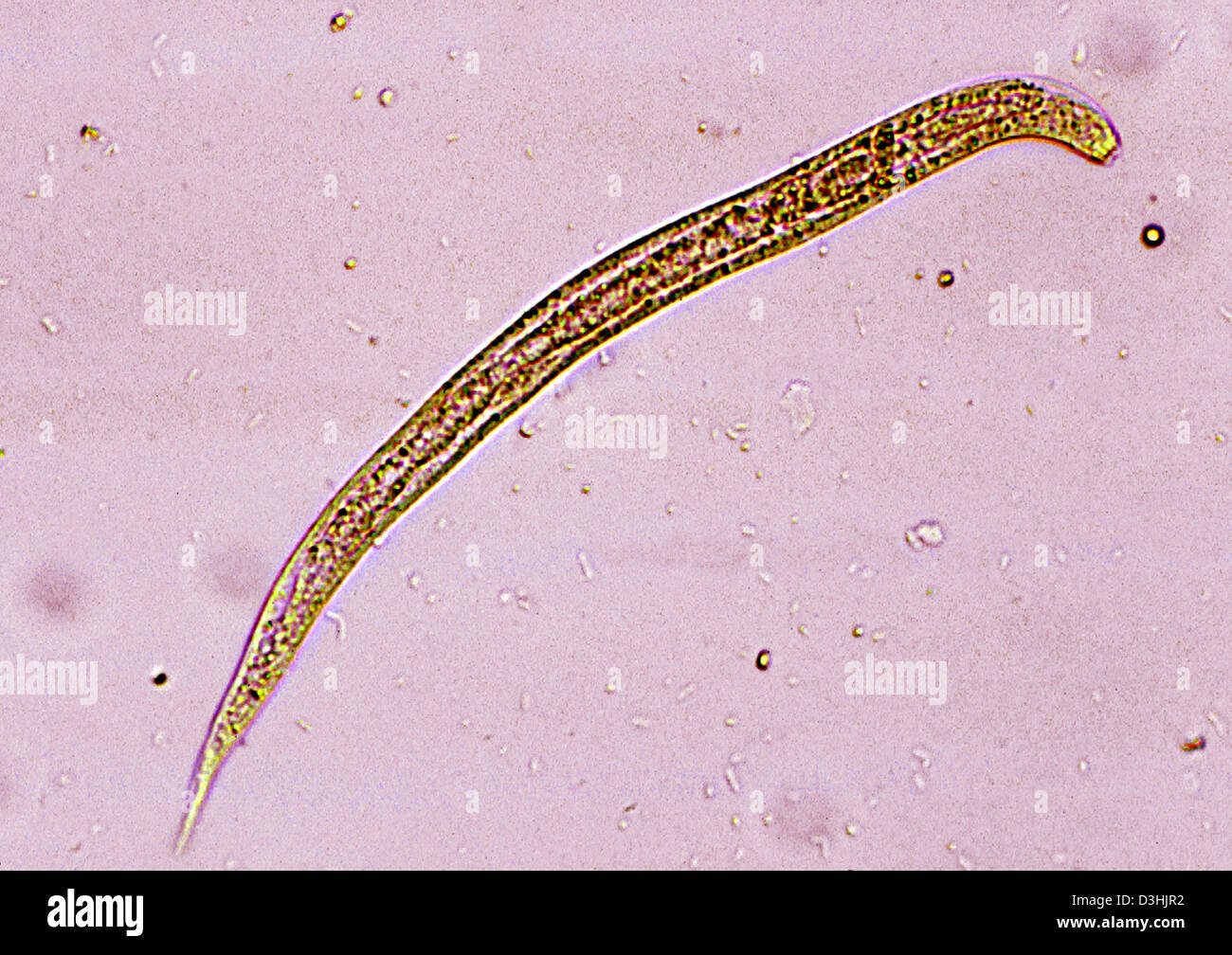 Strongyloides stercoralis nematode worm hi-res stock photography and ...