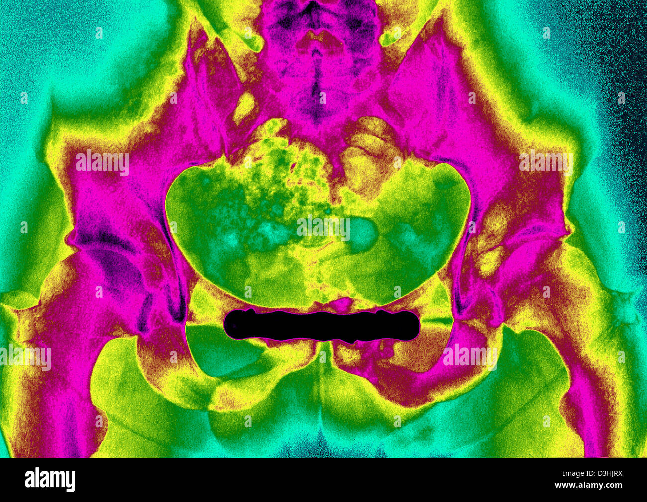 Mons pubis hi-res stock photography and images - Alamy