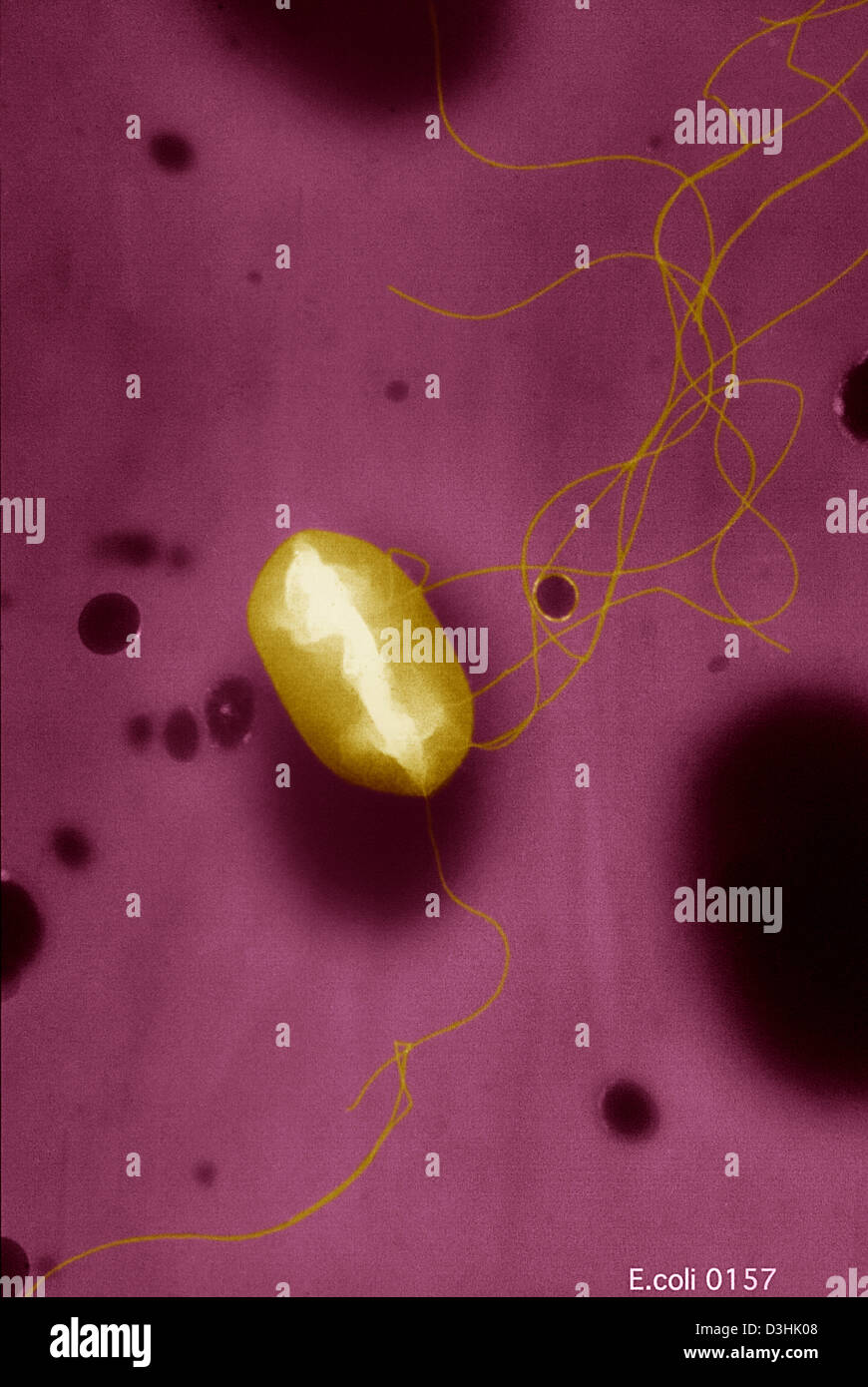 ESCHERICHIA COLI O157:H7, TEM Stock Photo - Alamy