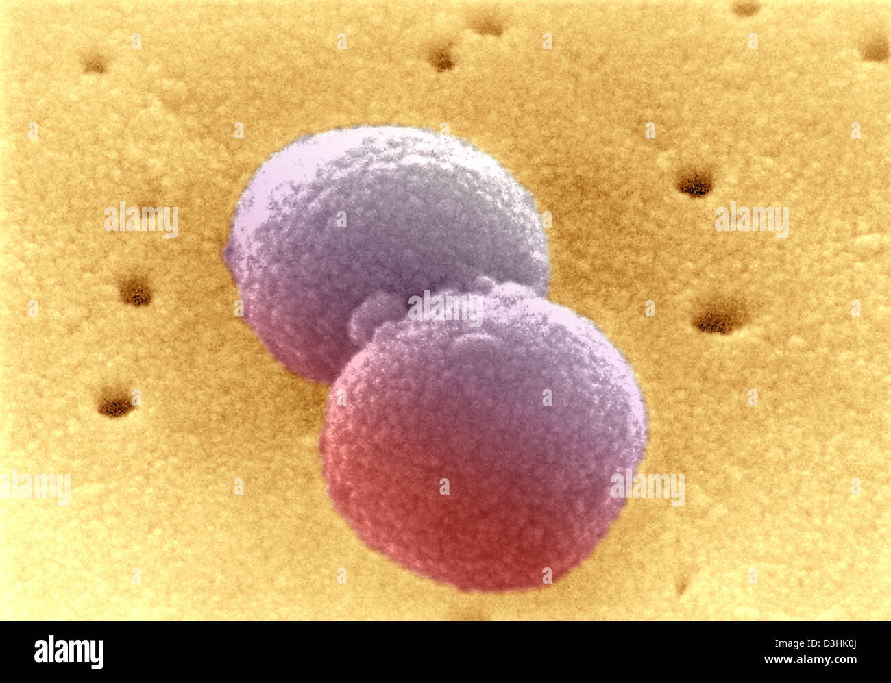 Streptococcus pneumoniae microscope hi-res stock photography and images ...