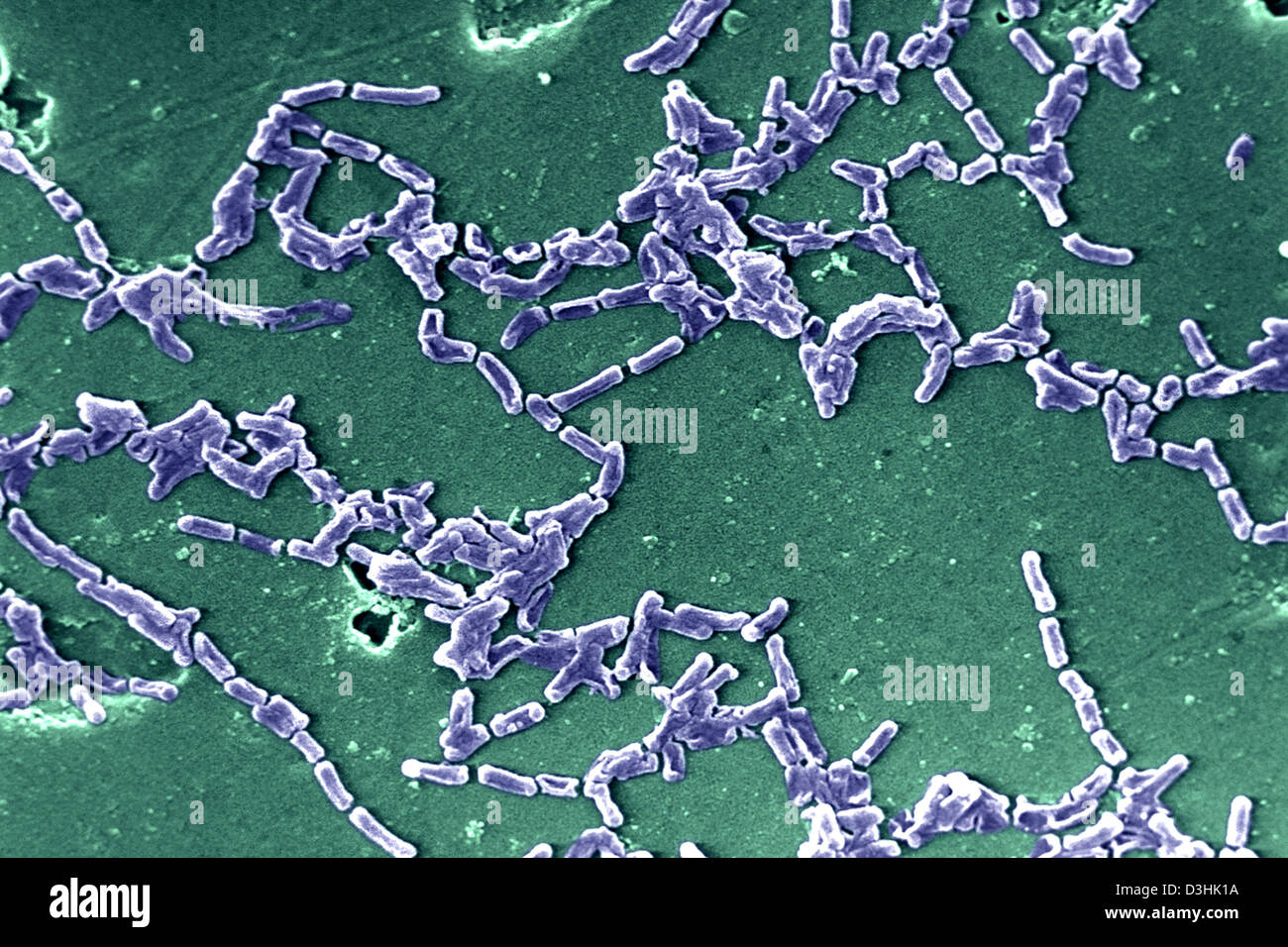 Mycobacterium chelonae hi-res stock photography and images - Alamy