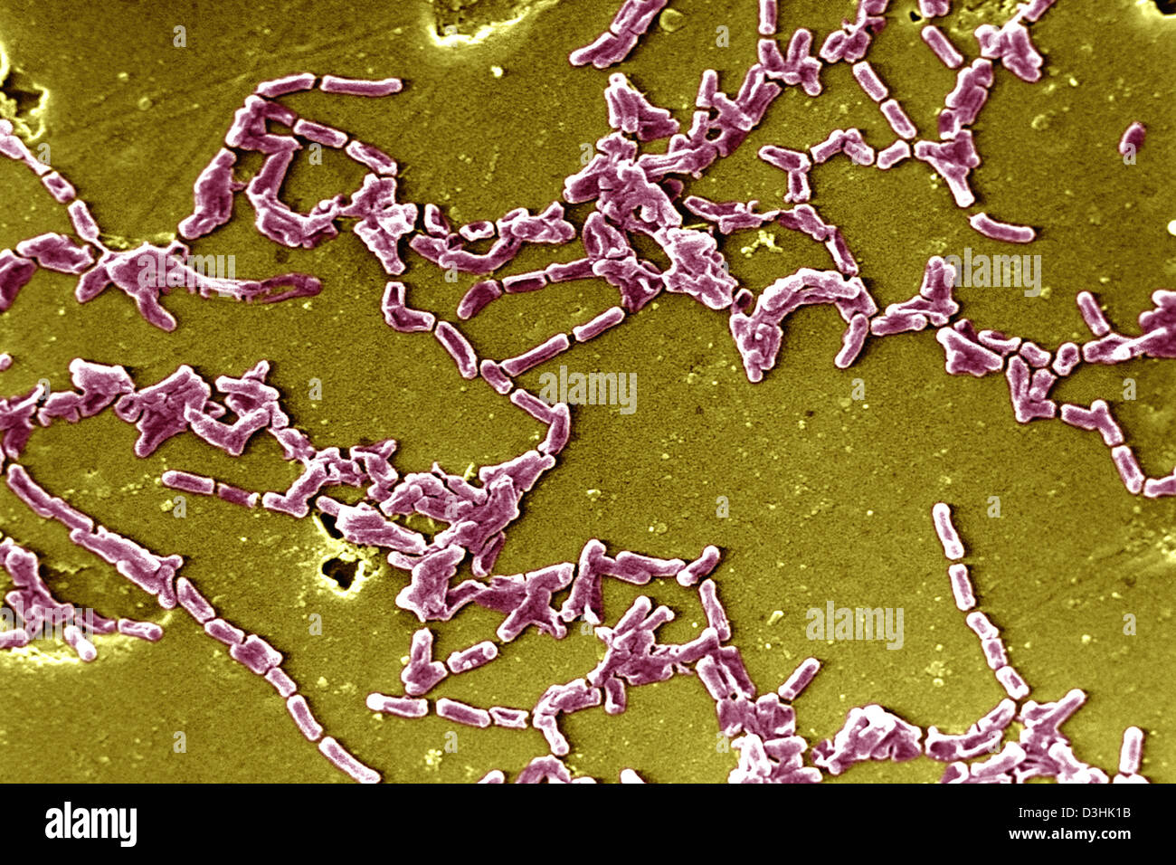 Mycobacterium chelonae hi-res stock photography and images - Alamy
