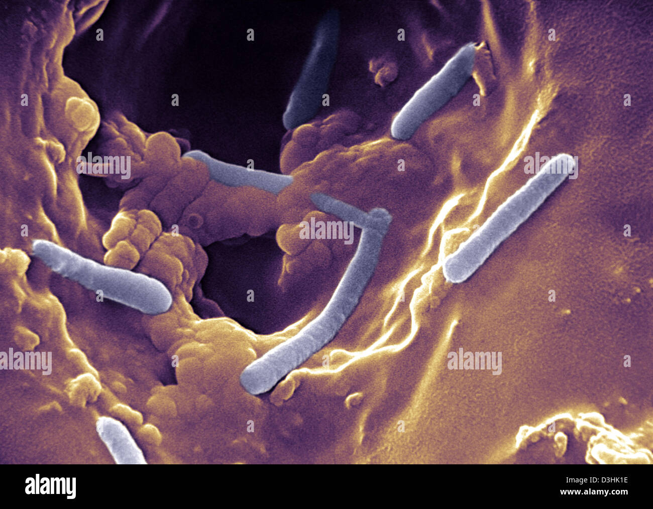 PSEUDOMONAS AERUGINOSA Stock Photo - Alamy