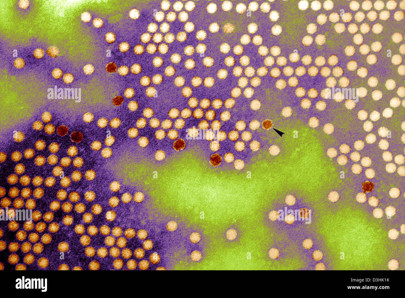 Polio virus microscope hi-res stock photography and images - Alamy