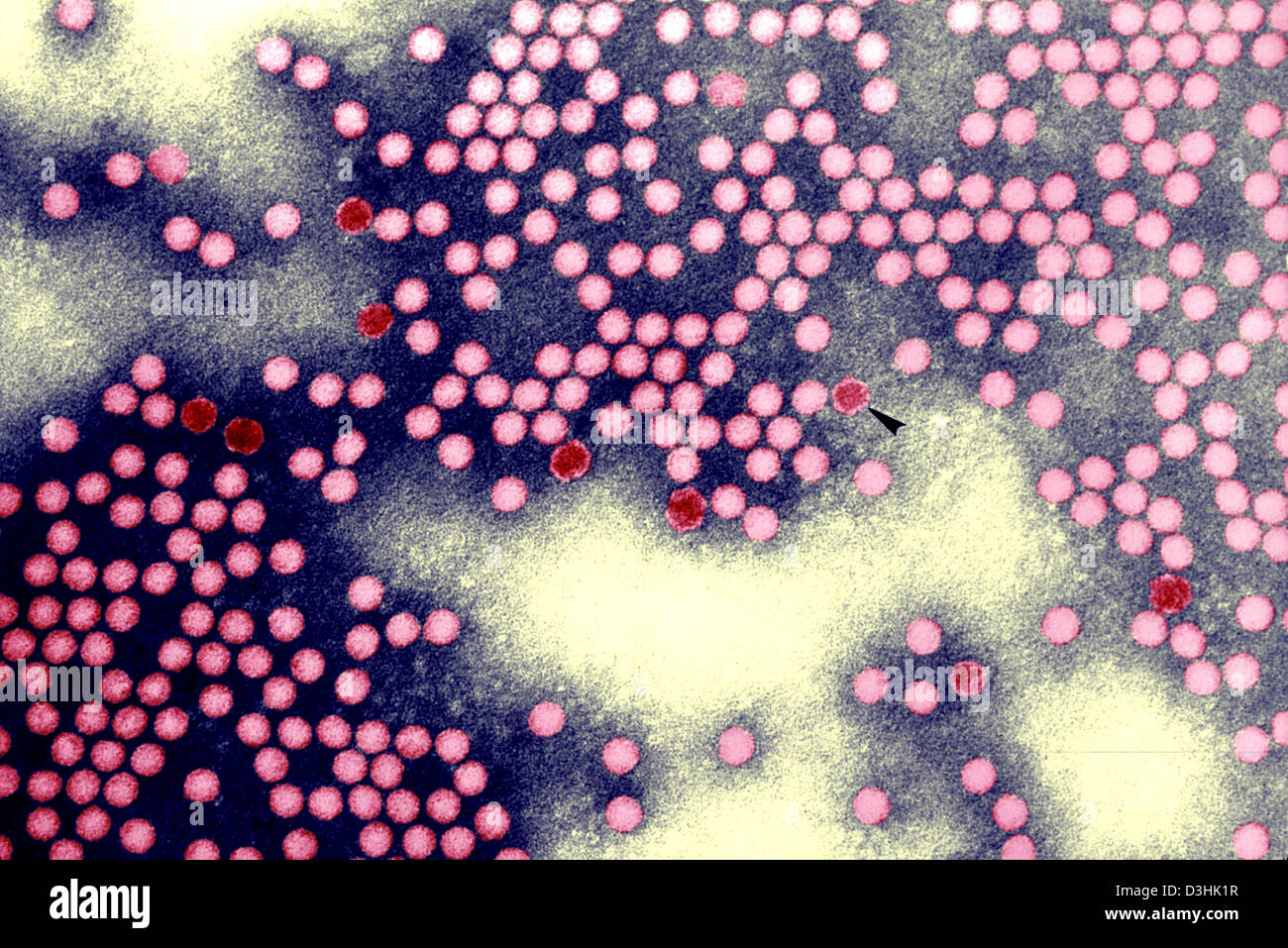 Polio virus microscope hi-res stock photography and images - Alamy