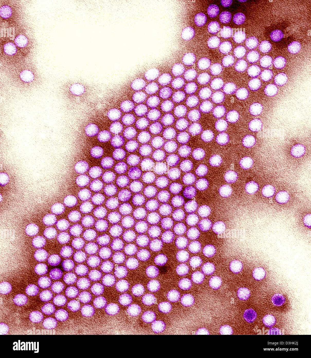 Polio virus microscope hi-res stock photography and images - Alamy