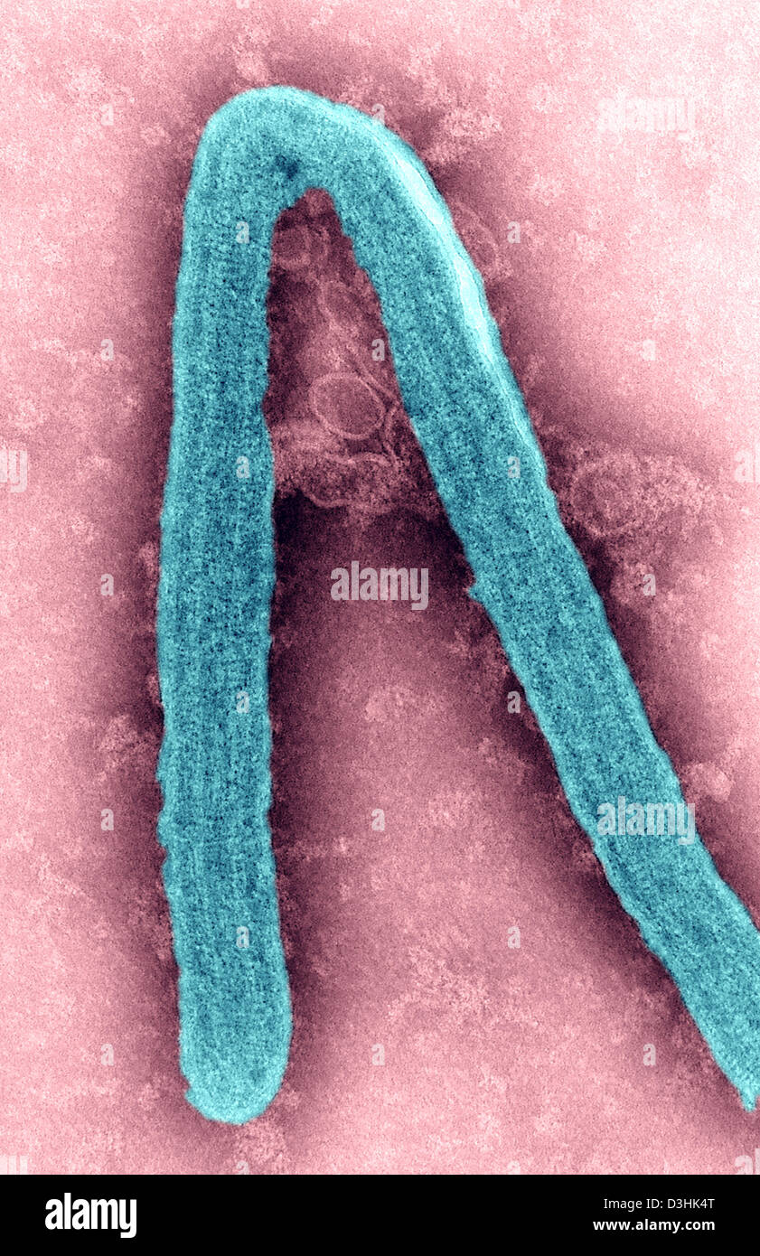 Marburg disease hi-res stock photography and images - Alamy