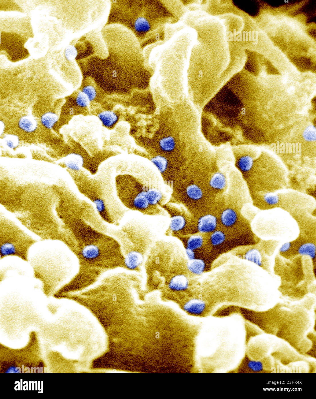 Scanning electron micrograph sem lymphocyte hi-res stock photography ...