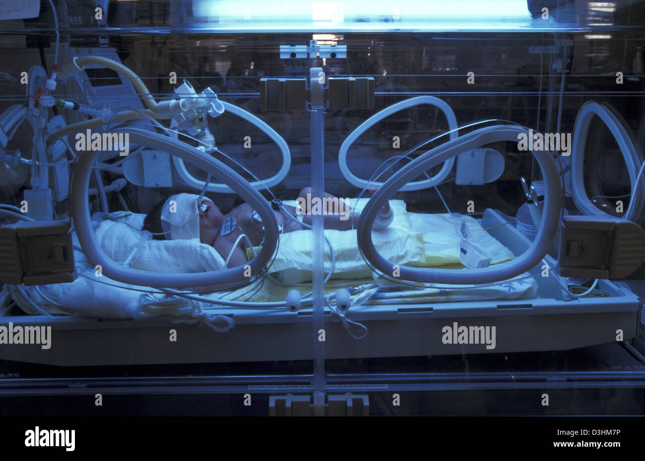 Neonatorum hi-res stock photography and images - Alamy