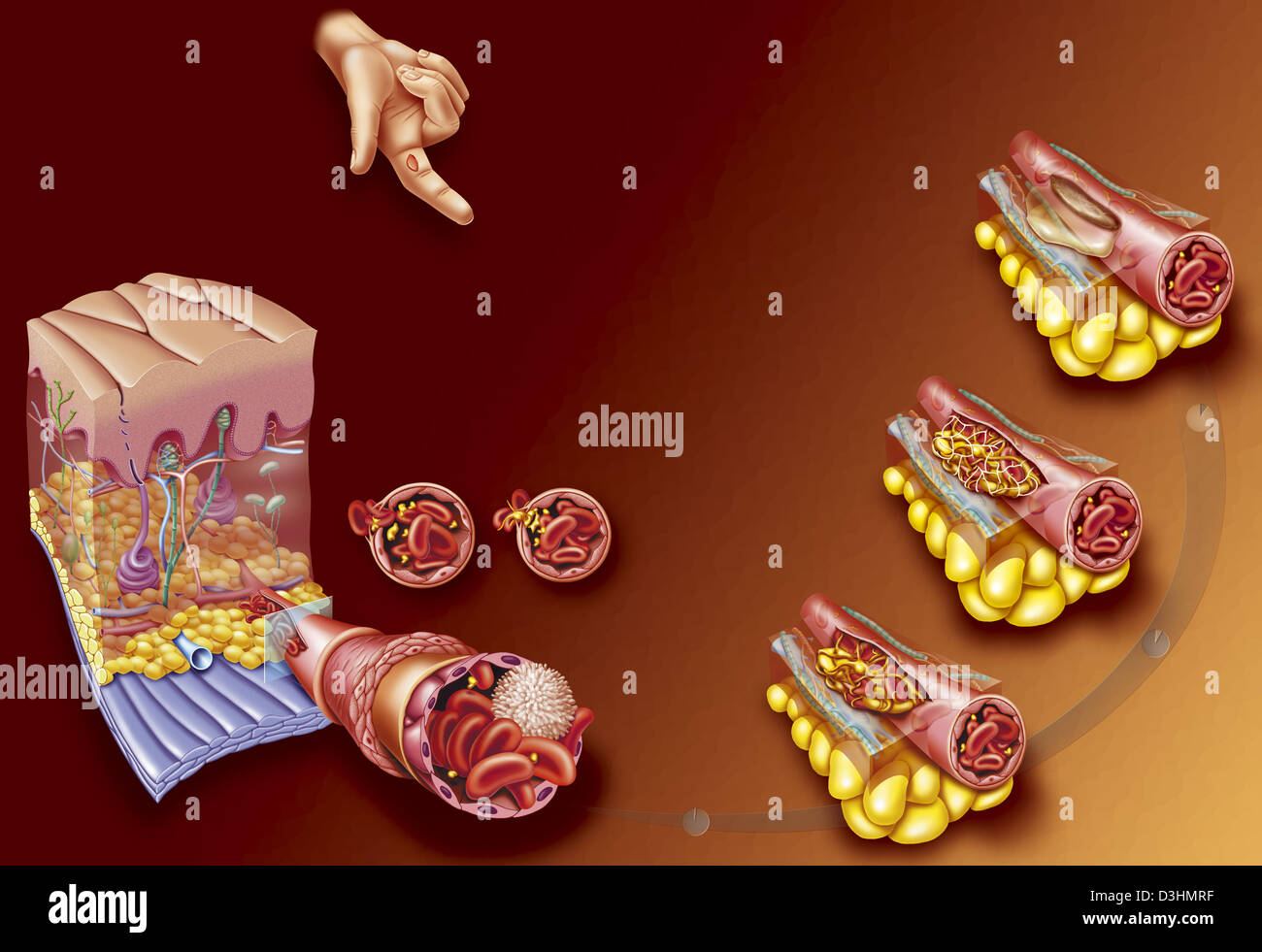 Cicatrization hi-res stock photography and images - Alamy