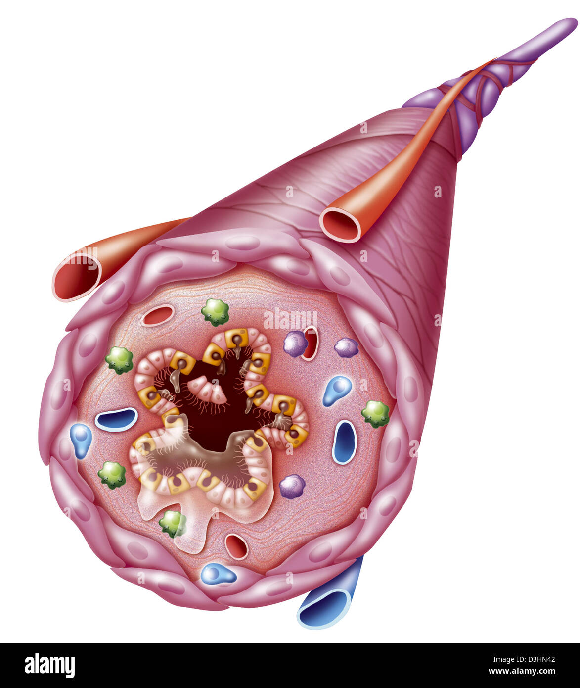 Asthma illustration hi-res stock photography and images - Alamy