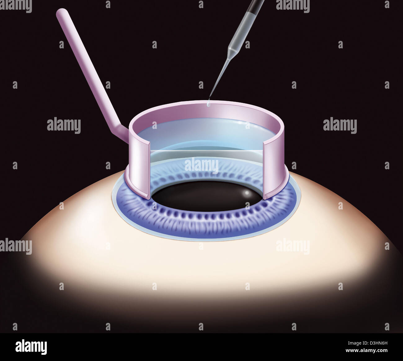 Lasek High Resolution Stock Photography and Images - Alamy