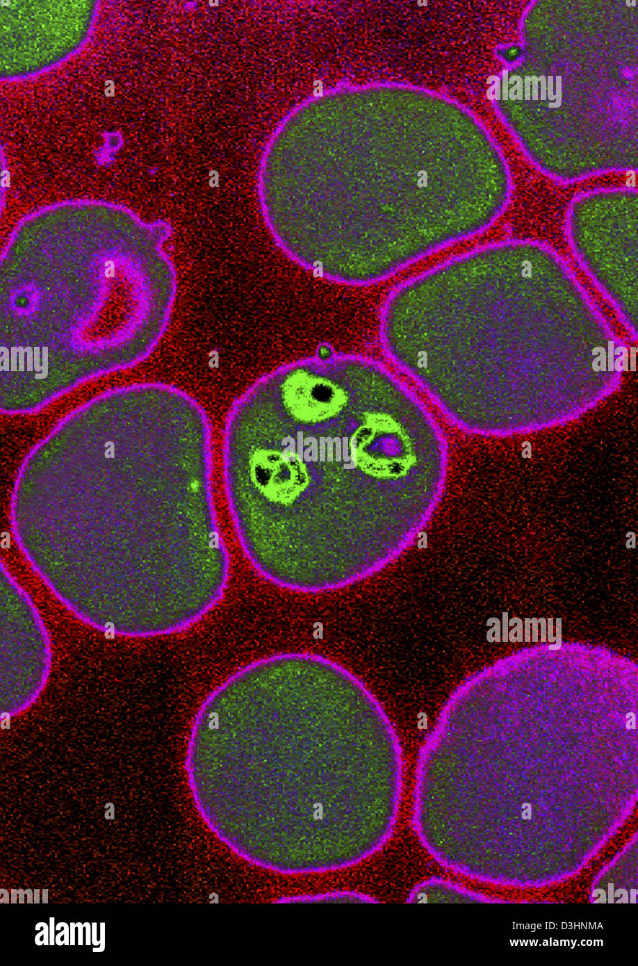 Blood smear plasmodium falciparum hi-res stock photography and images ...