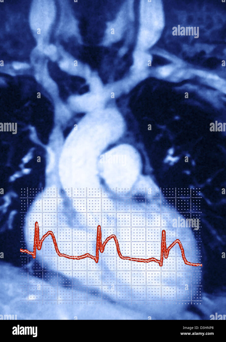 Cardiac mri imaging hi-res stock photography and images - Alamy