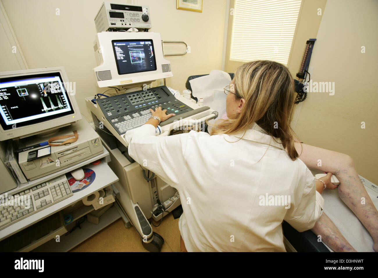 DOPPLER TEST OF A VEIN Stock Photo - Alamy