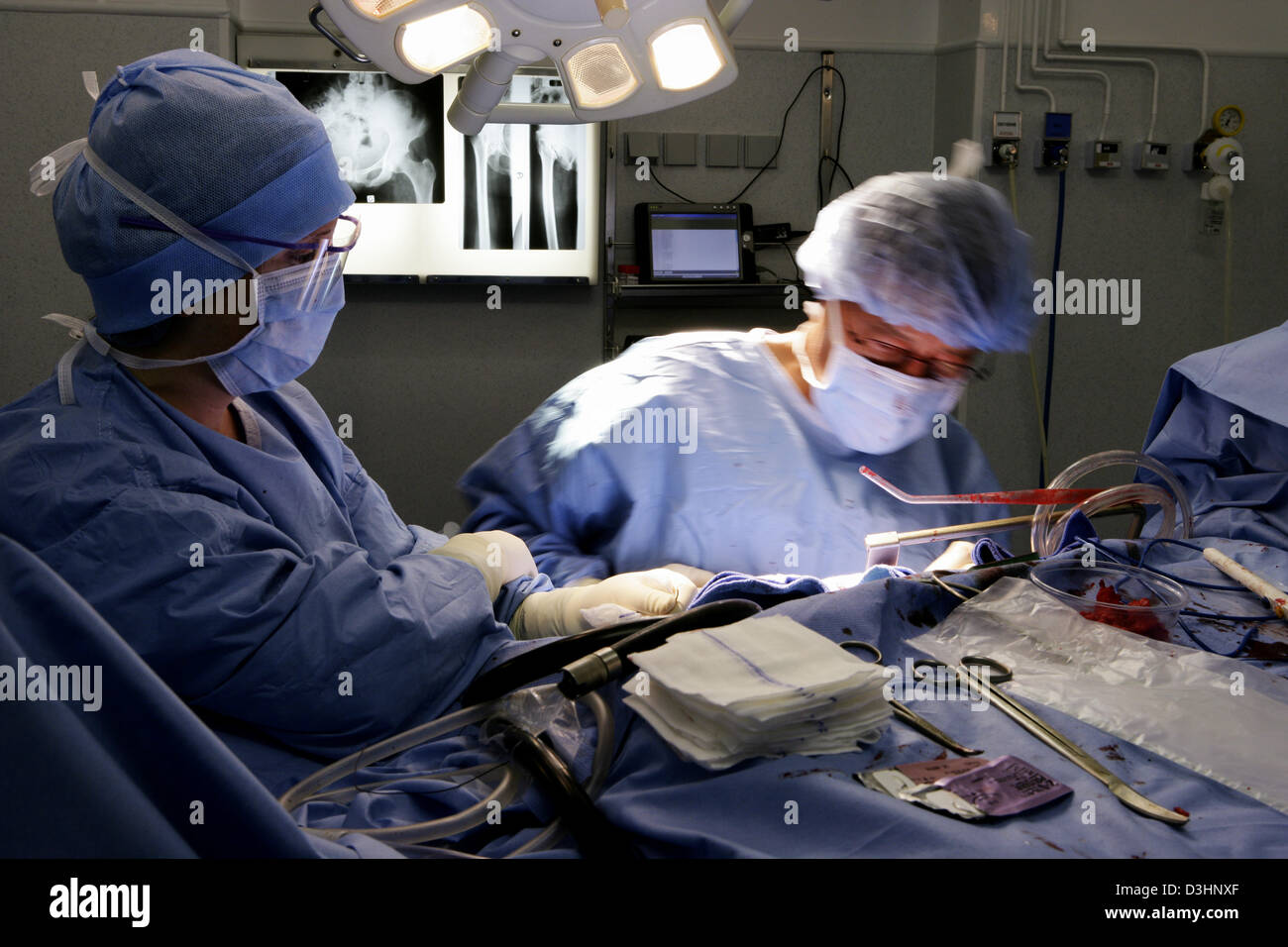 HIP PROSTHESIS, SURGERY Stock Photo - Alamy