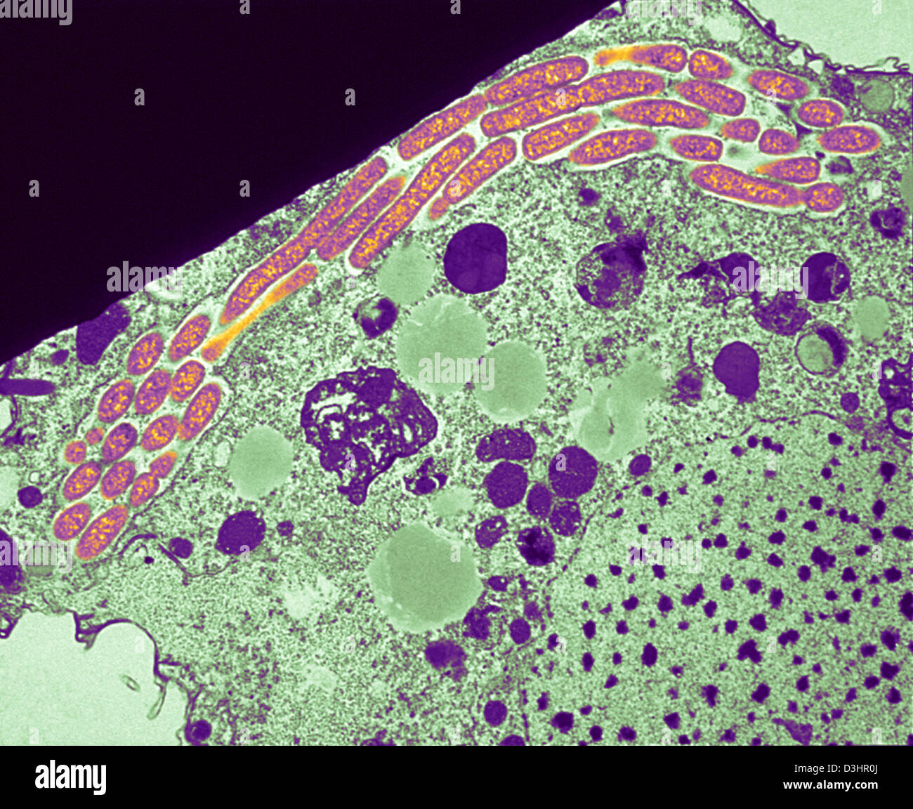 Legionellaceae hi-res stock photography and images - Alamy