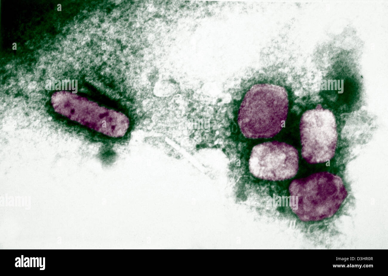 Smallpox virus microscope hi-res stock photography and images - Alamy