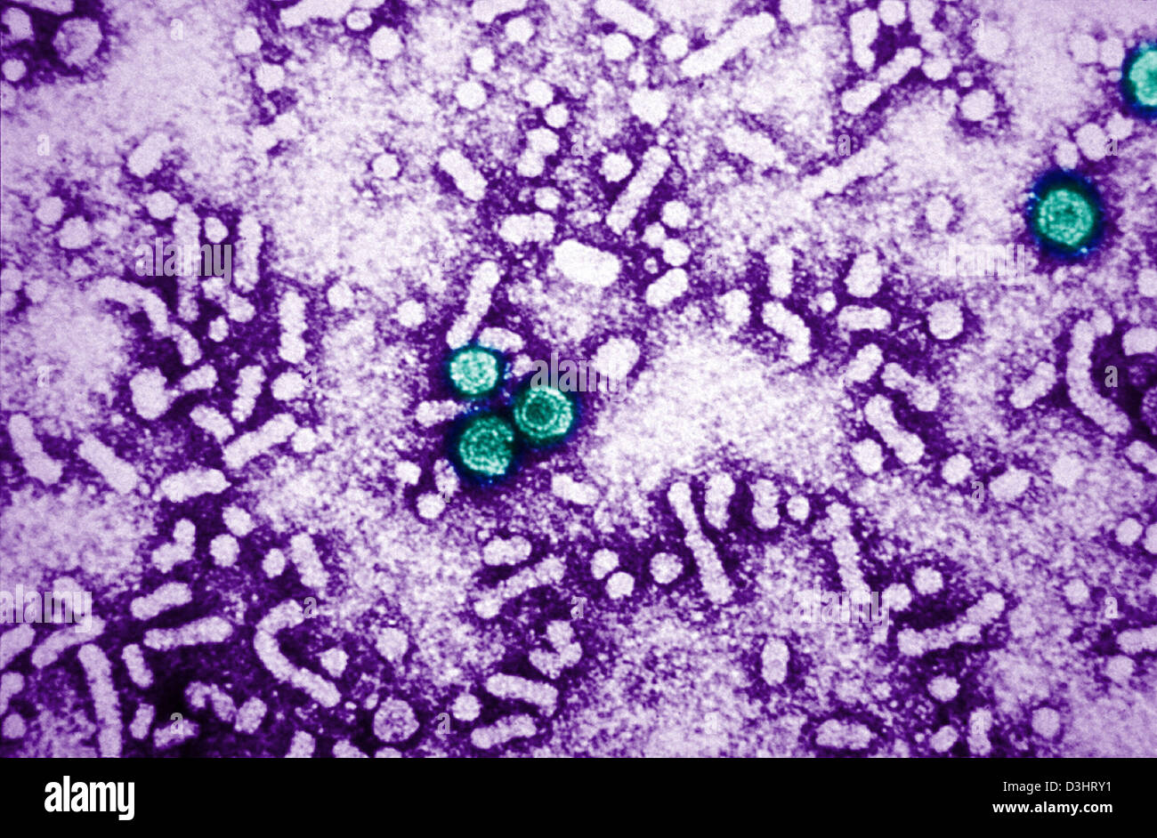 HEPATITIS B VIRUS Stock Photo - Alamy
