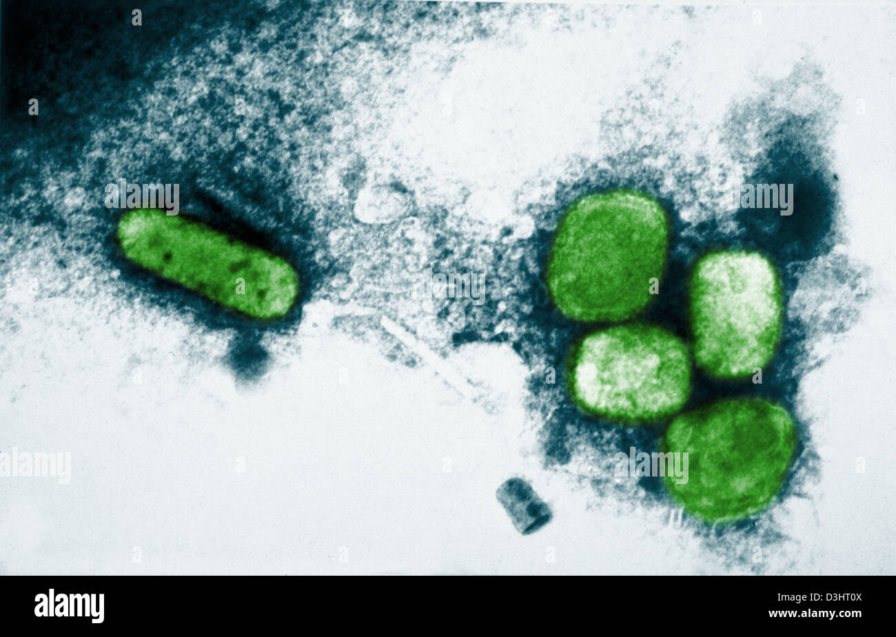 Variola Virus High Resolution Stock Photography and Images - Alamy