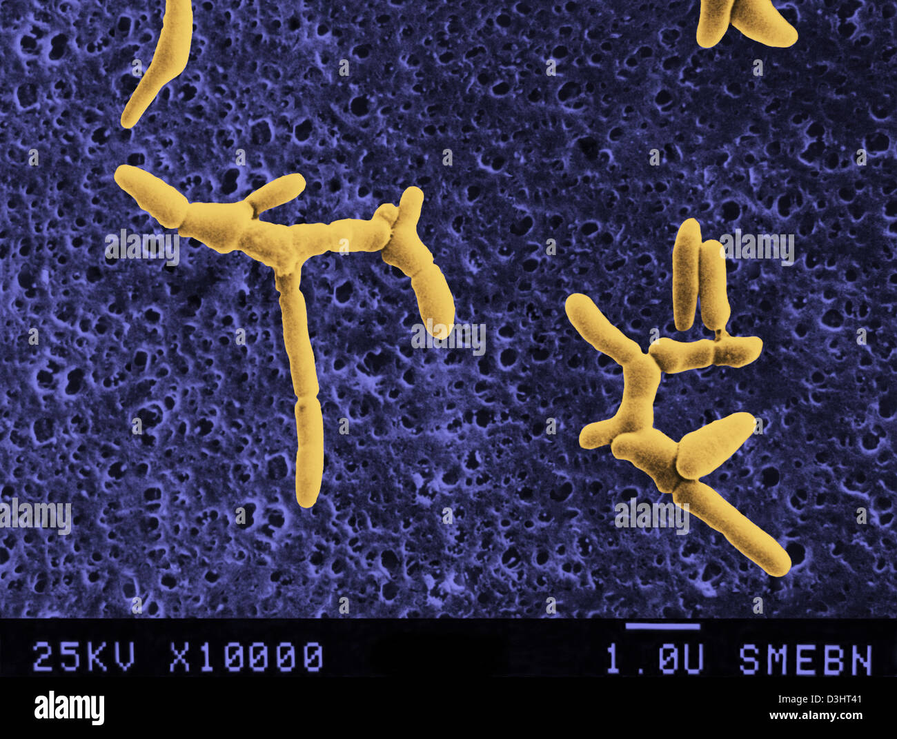 Listeria bacteria hi-res stock photography and images - Alamy