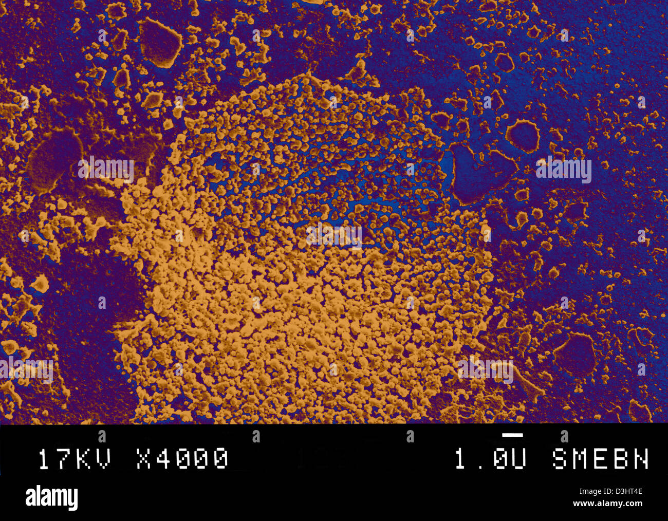 Mycoplasma Hominis High Resolution Stock Photography and Images - Alamy