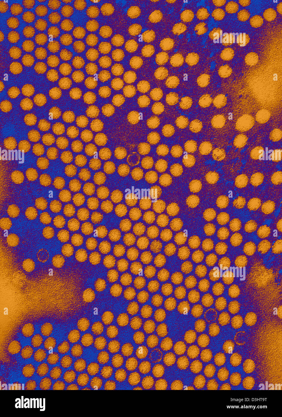 Polio virus microscope hi-res stock photography and images - Alamy