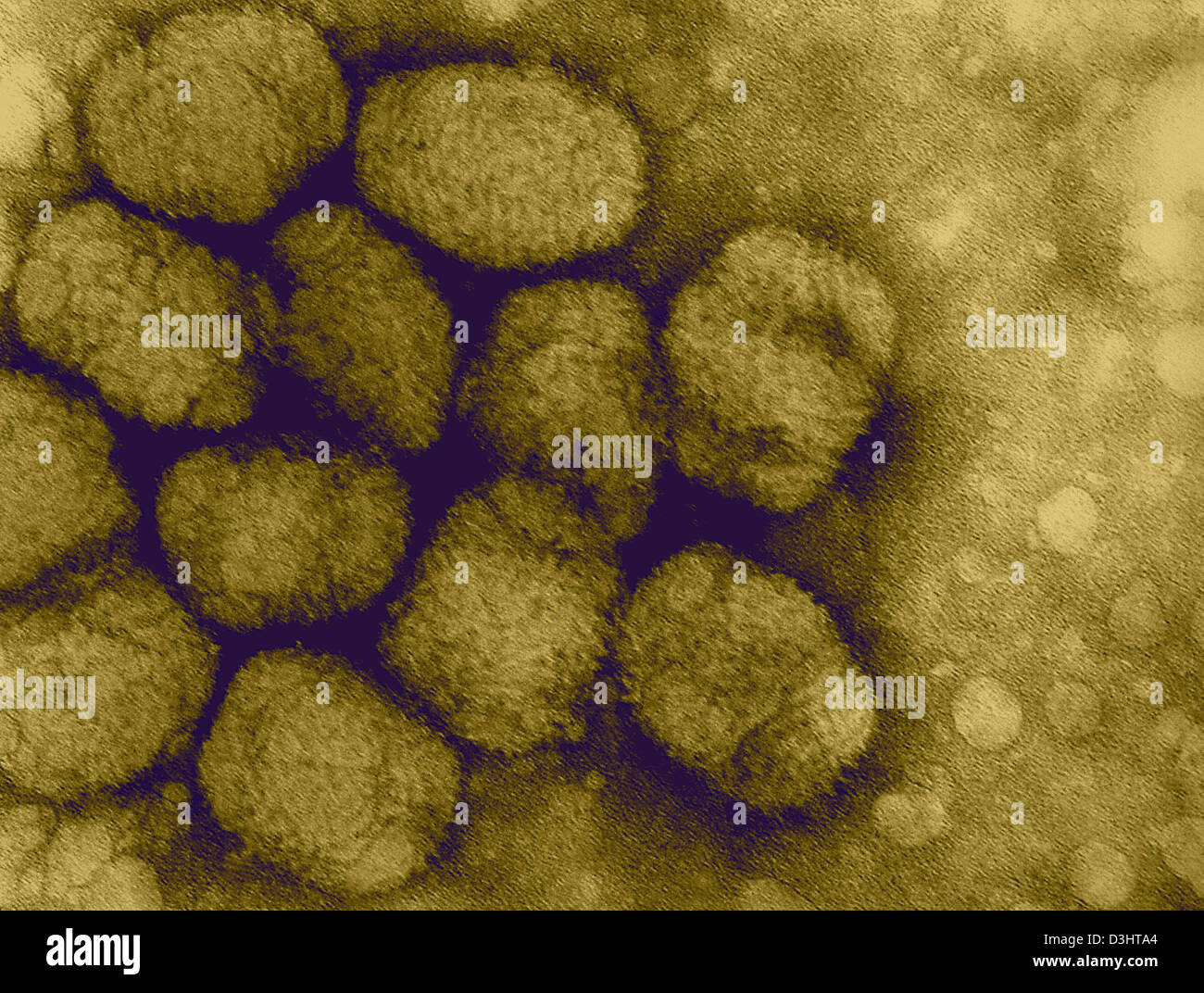 Electron Microscope Dna High Resolution Stock Photography and Images ...