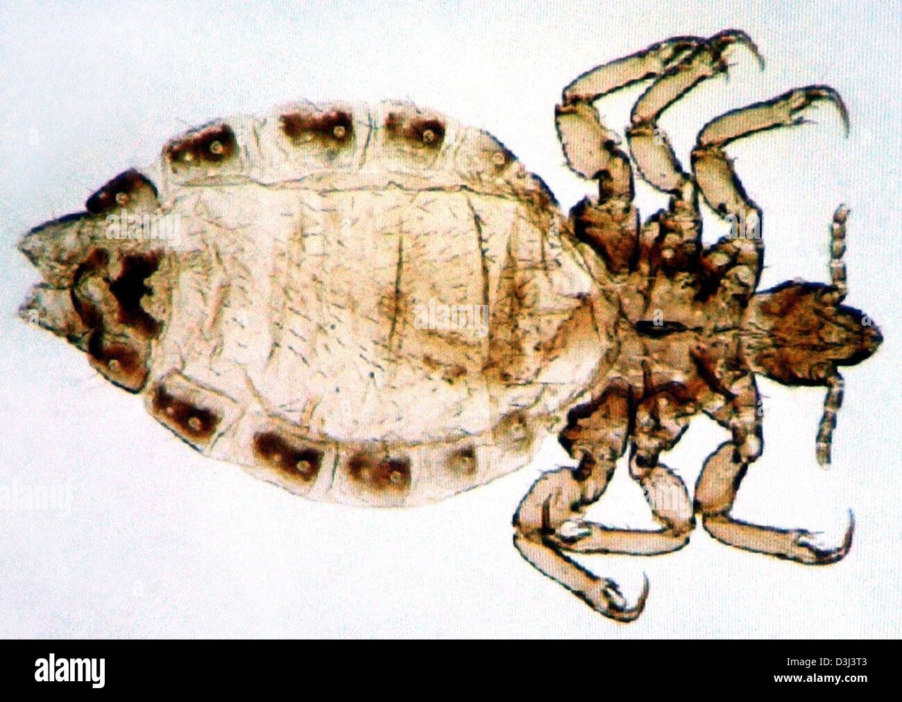 (dpa) - A view of a head louse on a computer screen at the Max-Planck ...