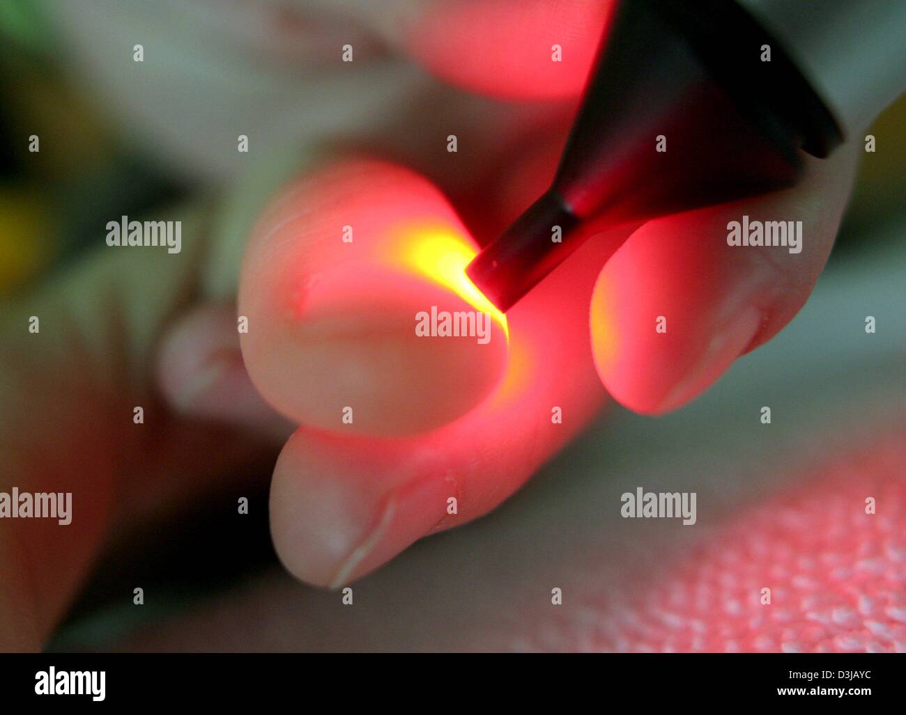 Laser acupuncture hi-res stock photography and images - Alamy