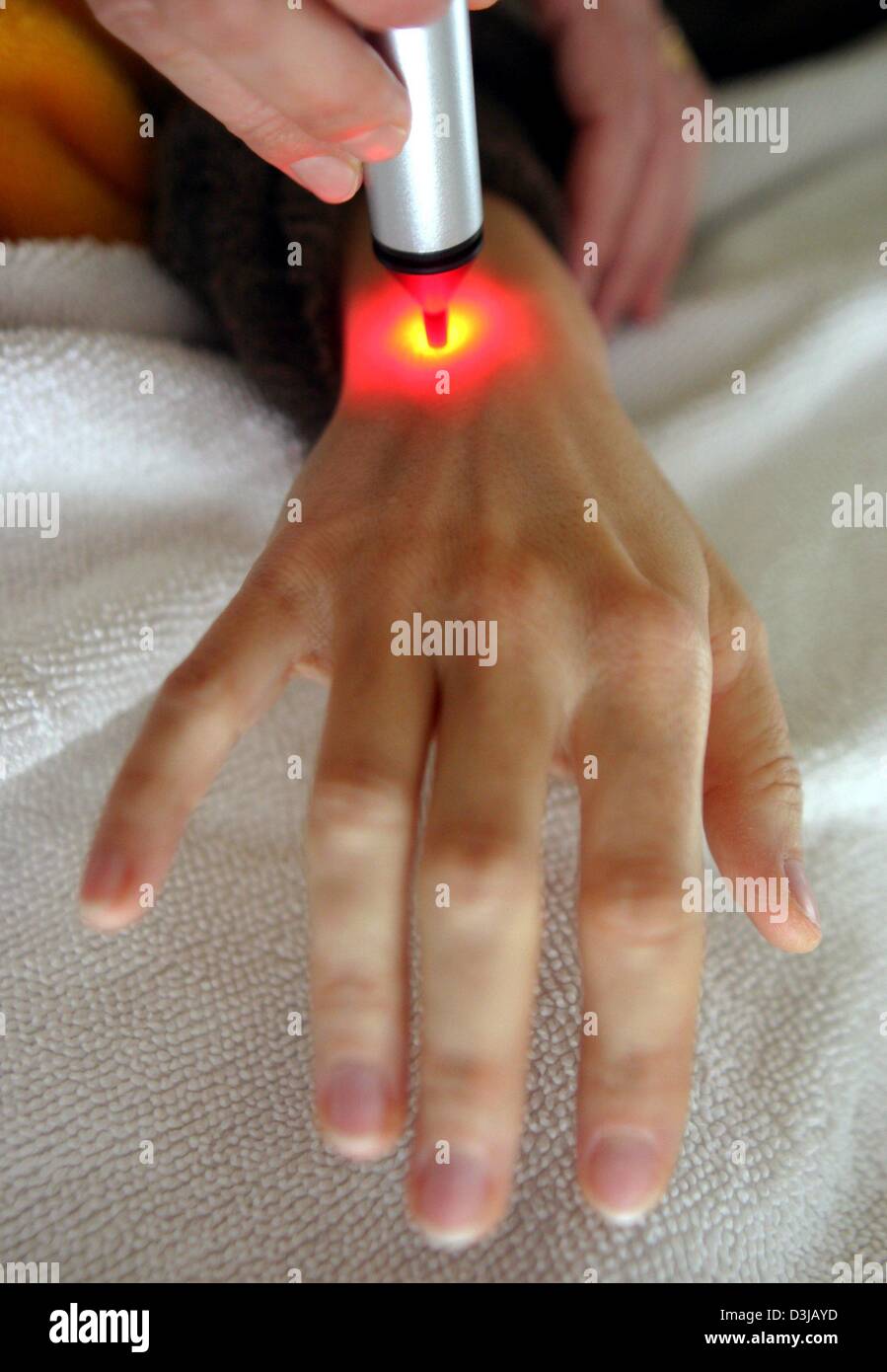 Laser acupuncture hi-res stock photography and images - Alamy
