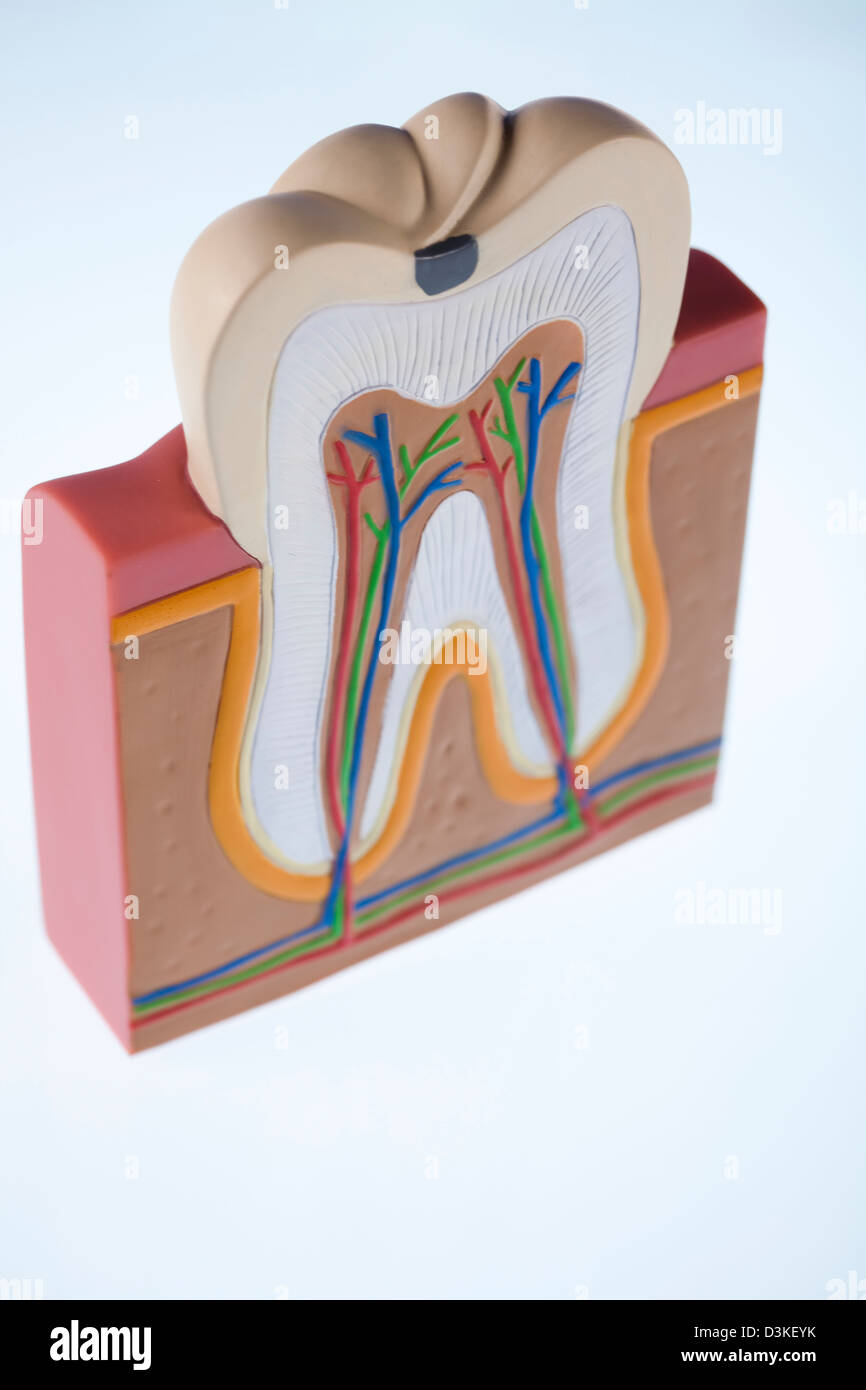 Human tooth structure with caries Stock Photo - Alamy