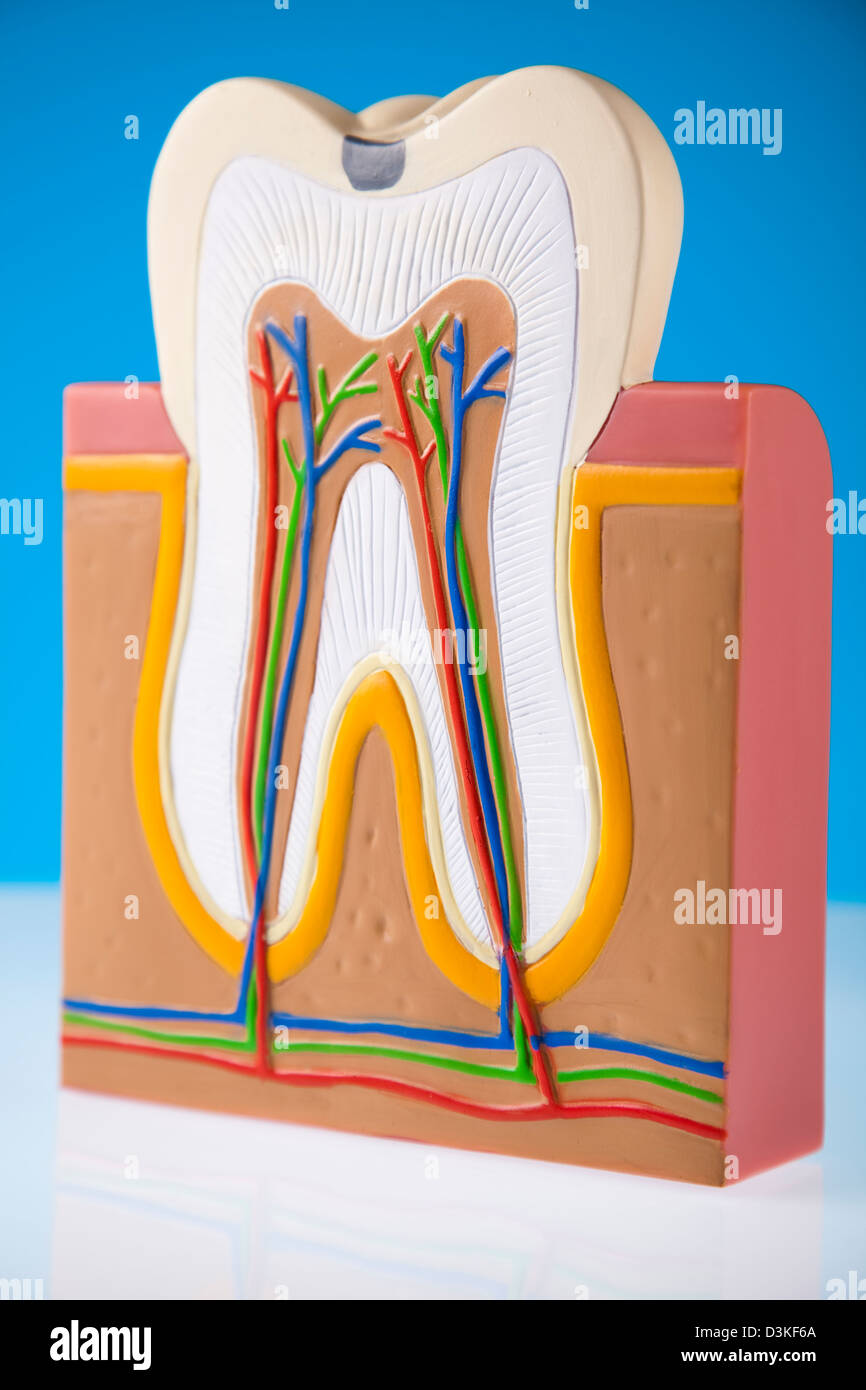 Human tooth structure with caries Stock Photo - Alamy
